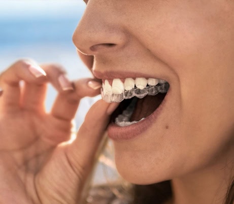 Invisalign for Adults | London Orthodontist | Boston Orthodontics